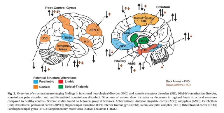 Can people with FND have changes to the structure of their brain too ...