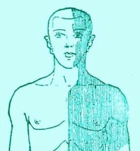 How has it happened? – Functional Neurological Disorder (FND)