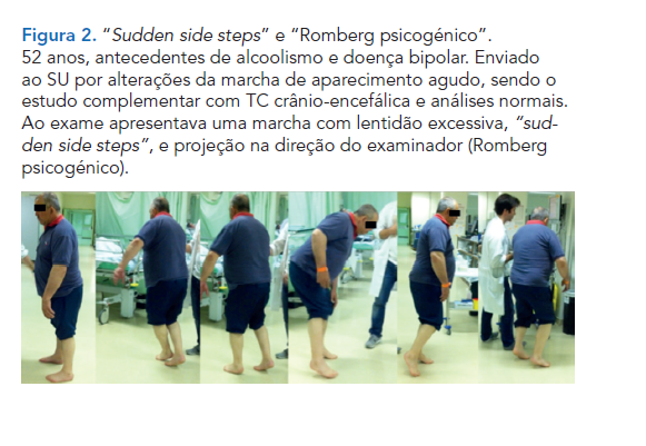 Alterações funcionais da marcha – Functional Neurological Disorder (FND)