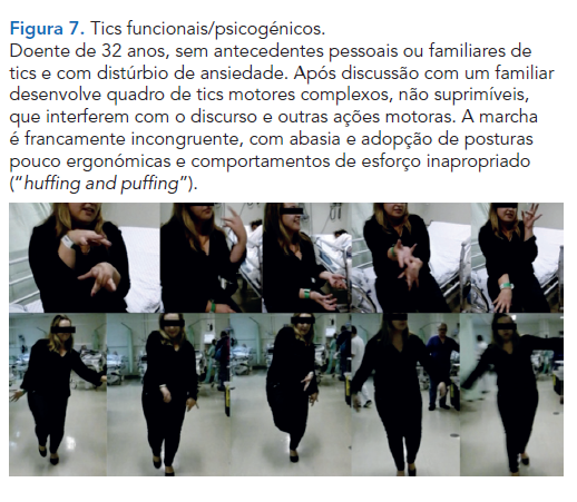 Tiques funcionais – Functional Neurological Disorder (FND)