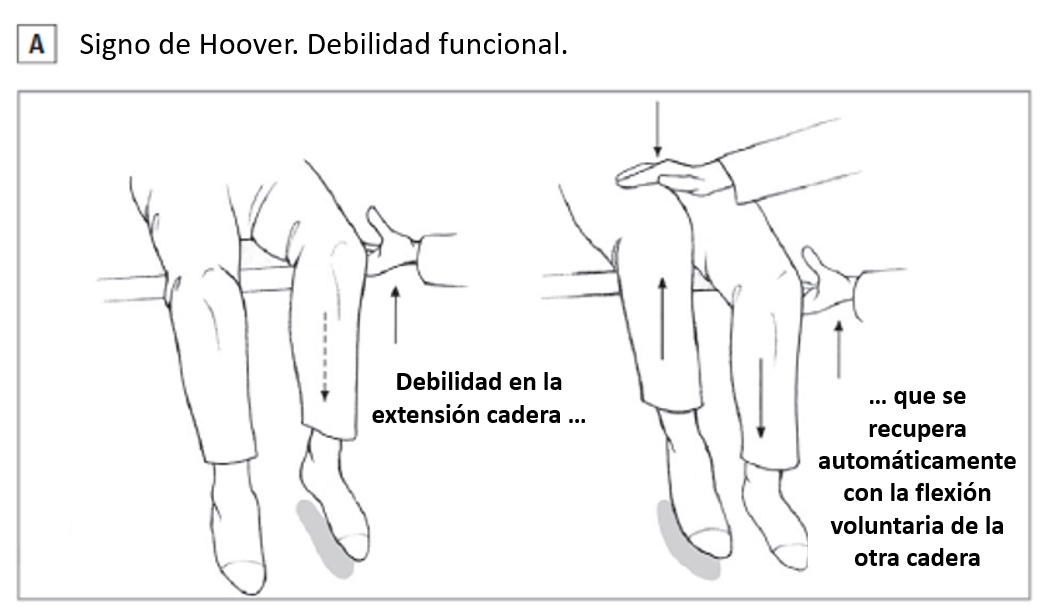 ¿Hasta qué punto son fiables los signos clínicos de TNF? – Functional ...